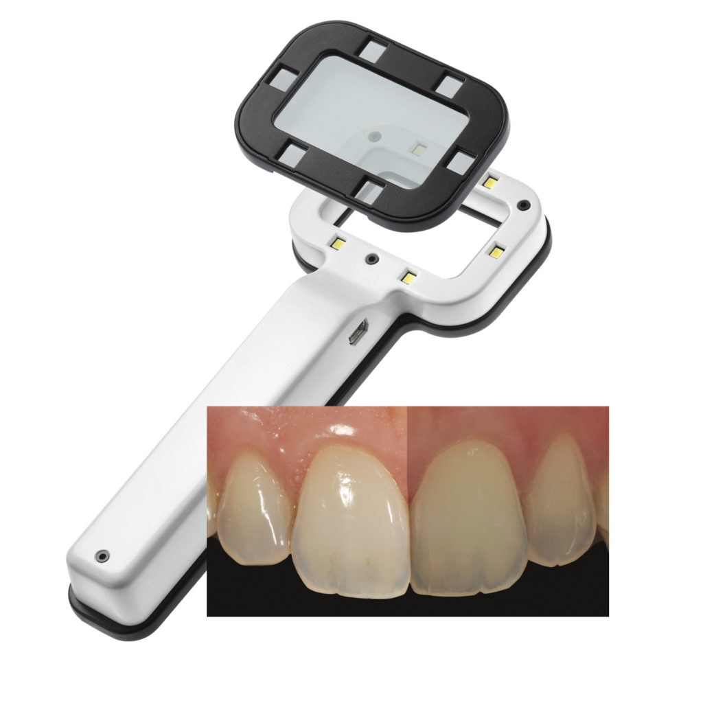 » Smile Lite – #6500